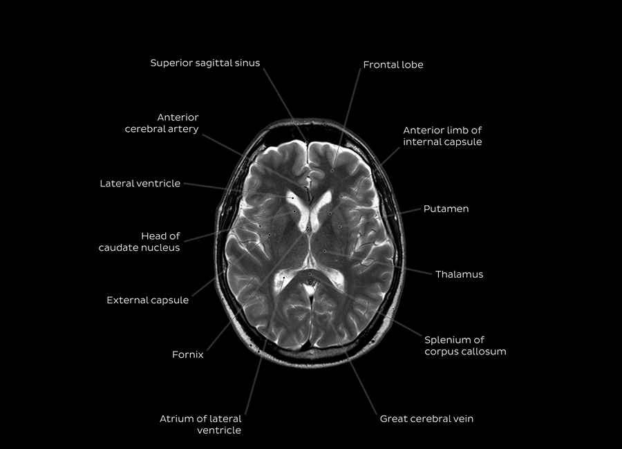MRI: Why you need it & what to expect before, during, and after ...